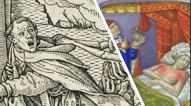 What was the sweating sickness and where did it come from….? – The New ...